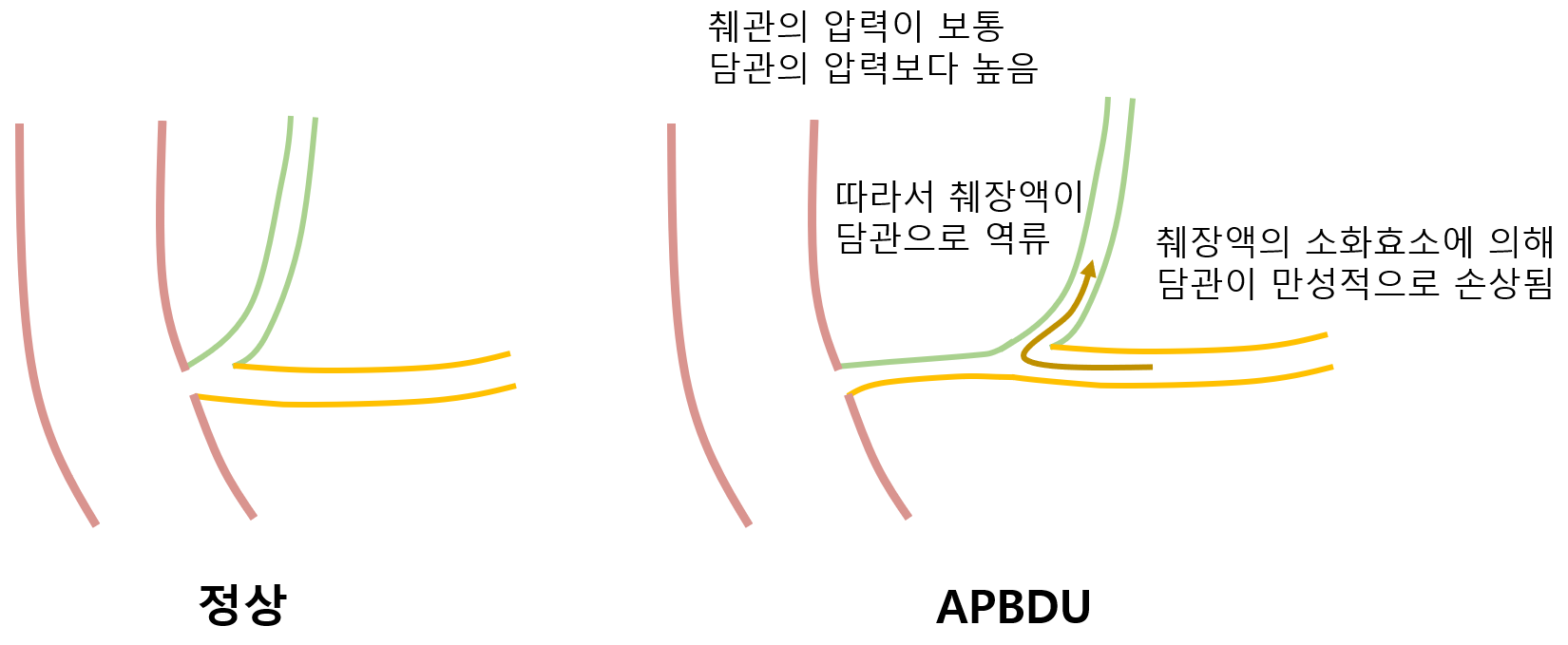 외과각론 | 담도 | 총담관낭 | 알렌의 서재