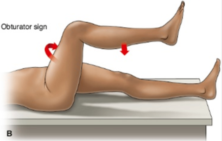 CPX/OSCE | 소화기 | 복통 | 알렌의 서재